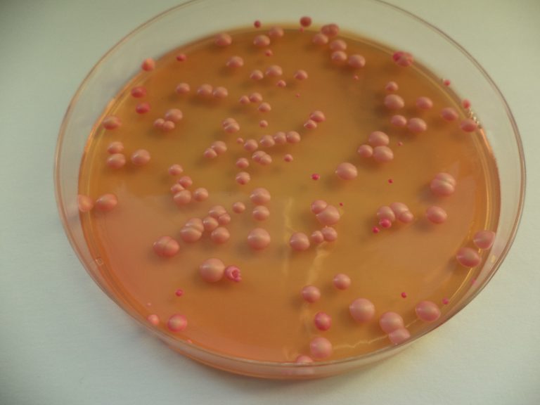 Out with the old! In with the…old? Brettanomyces: A spontaneous ...