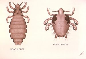 Pthirus pubis: An insect we can all agree is a pest in everything it ...